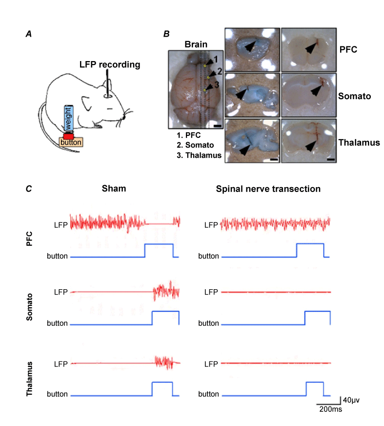 The weight was used for the paw pressure stimulation.