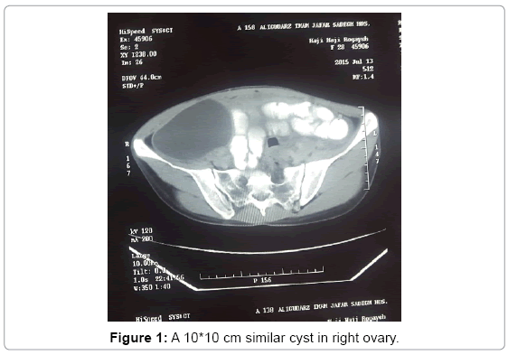 Clinical Case Reports 10 10 Cm Similar Cys