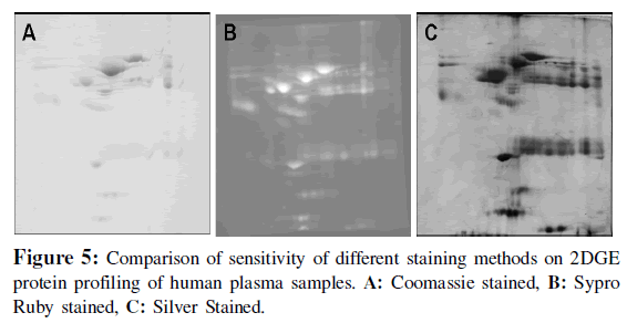 An Effective Method For The Analysis Of Human Plasma Proteome Using Two