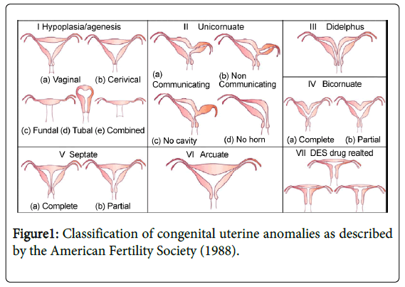 Sexual Disorders Congenital Uterine Anomalies