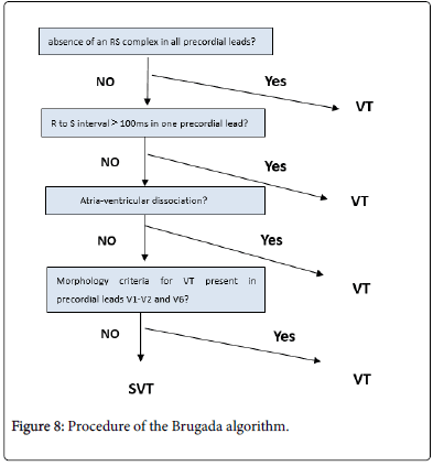 cardiovascular-diseases-diagnosis-brugada