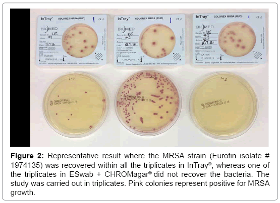 Medical Microbiology Diagnosis Mrsa Strain